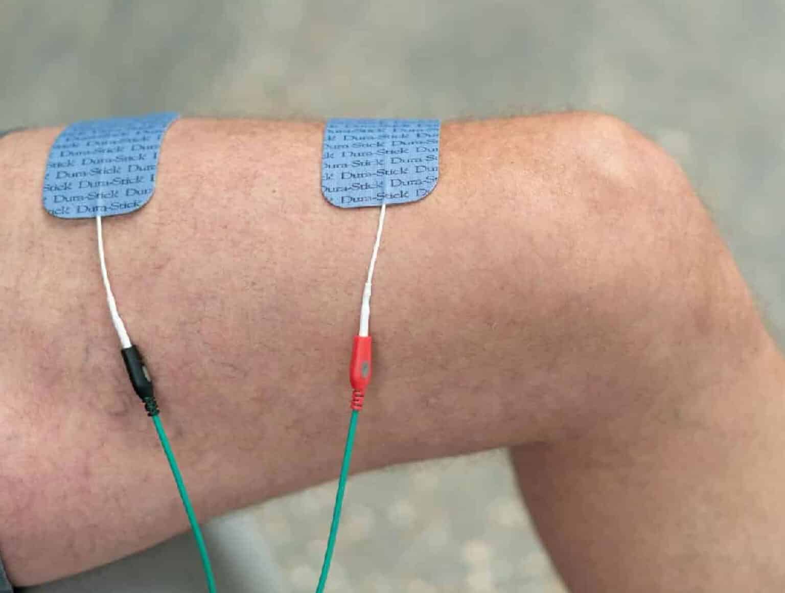 Stim Intelect Mobile 2 - Locamed